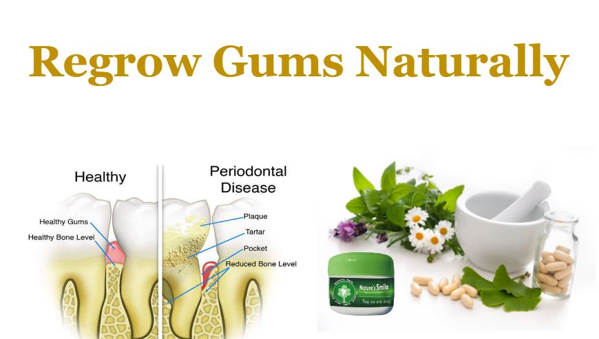 Receding Gum Toothpaste