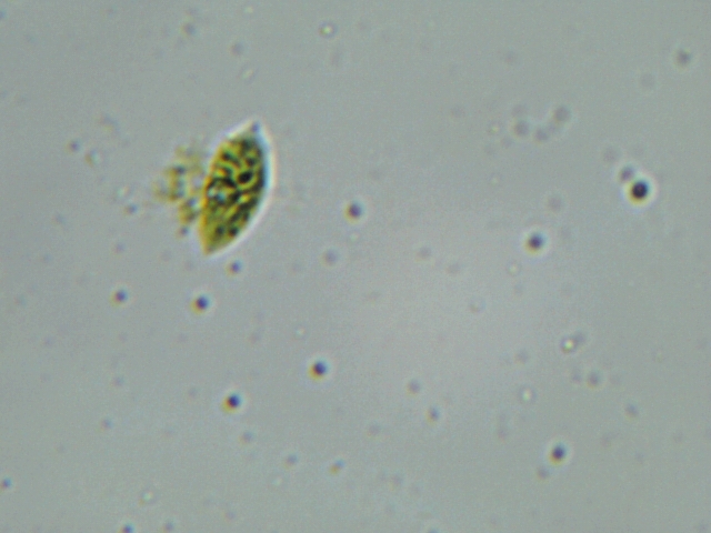 Amateur Algae culturing and cultivation : More Characium pringsheimii ...