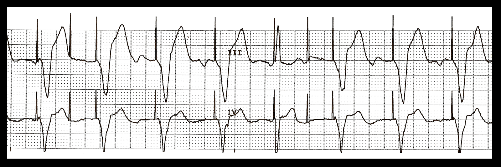 Various Demand Pacing