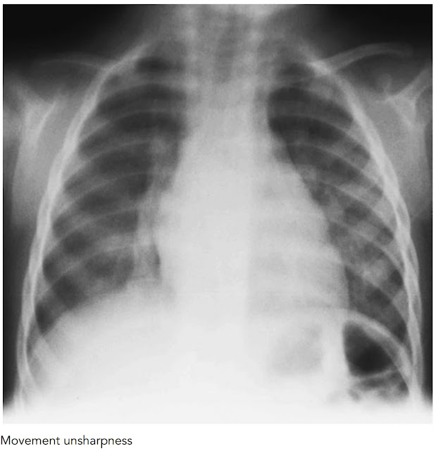 Clark's Radiography: Image Sharpness