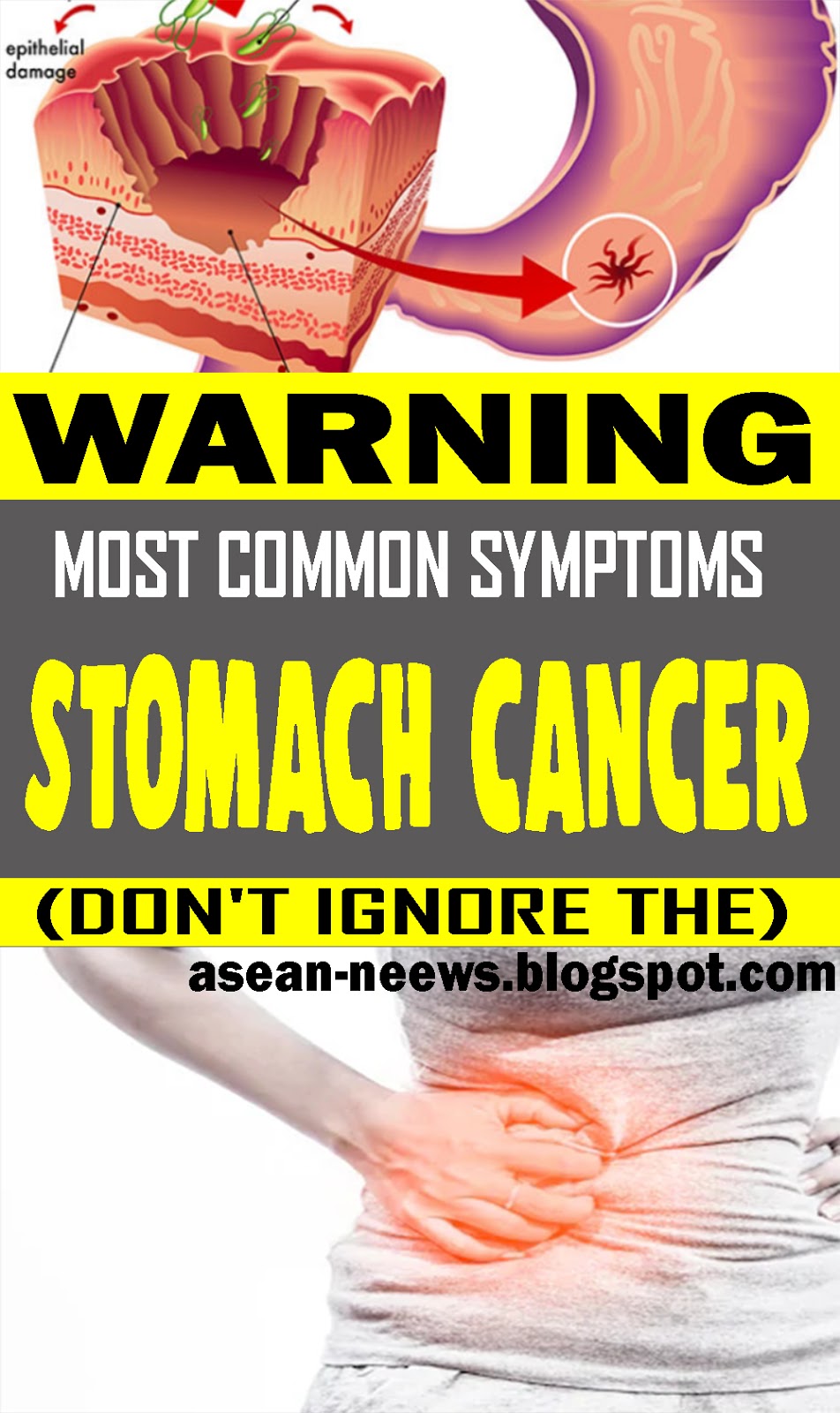 Stomach Cancer: A Silent Killer – Most Common Symptoms (Don’t Ignore ...