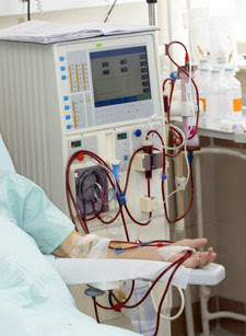 Dialyser Machine an artificial kidney