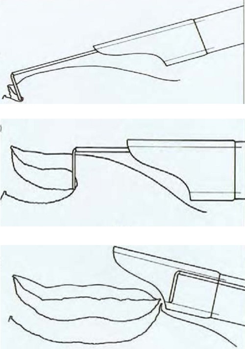 How to perform TURP? (post) step-by-step operative urology series