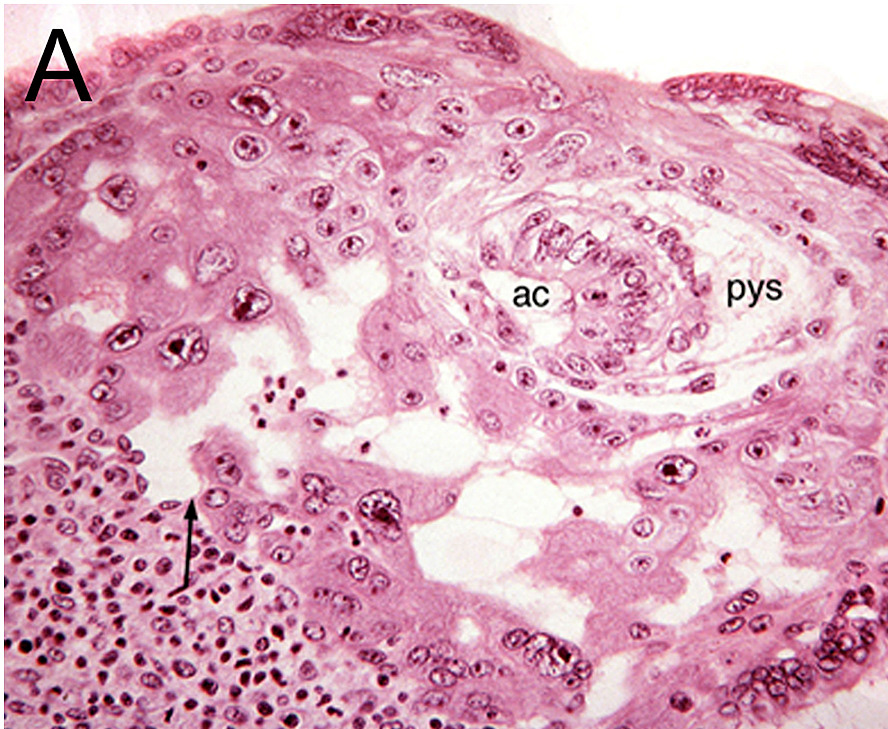 The Evolving Placenta: Carnegie Collection of human embryos