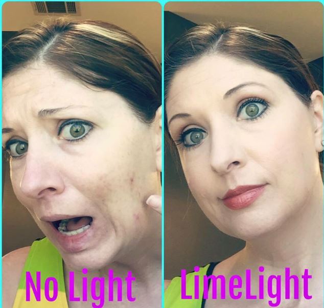 LimeLight get in on the Ground Floor with the Pros