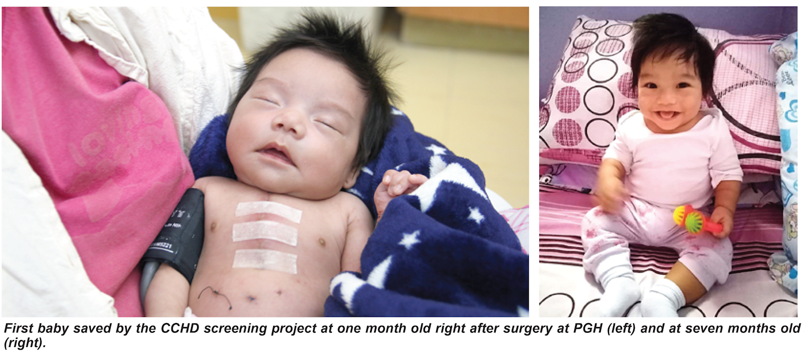 Emerging Screening Initiatives: CCHD and National Vision Screening ...