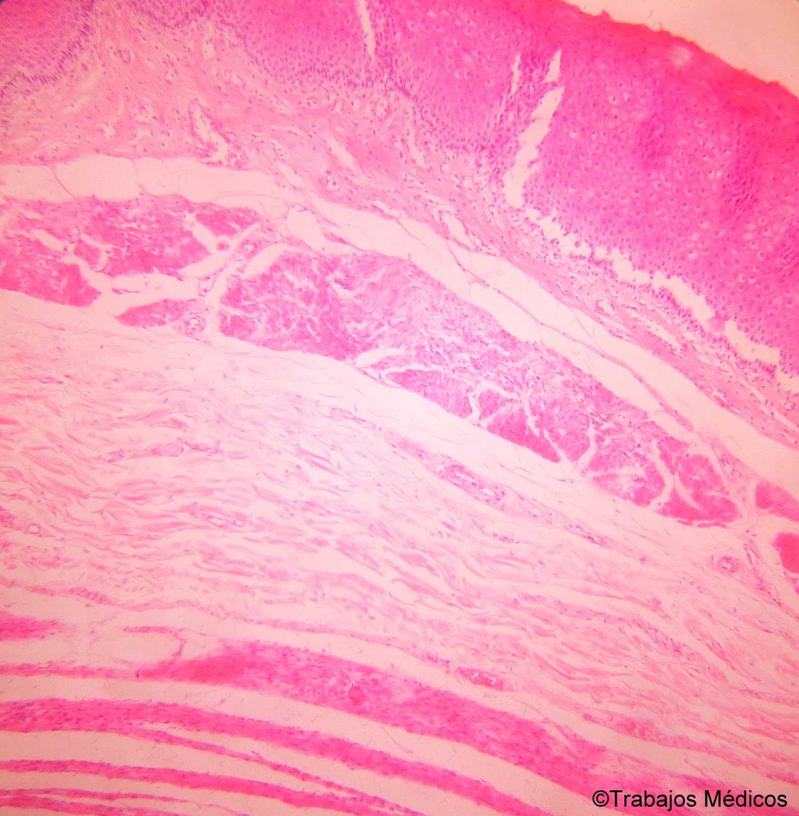 ESÓFAGO - PLACAS HISTOLÓGICAS