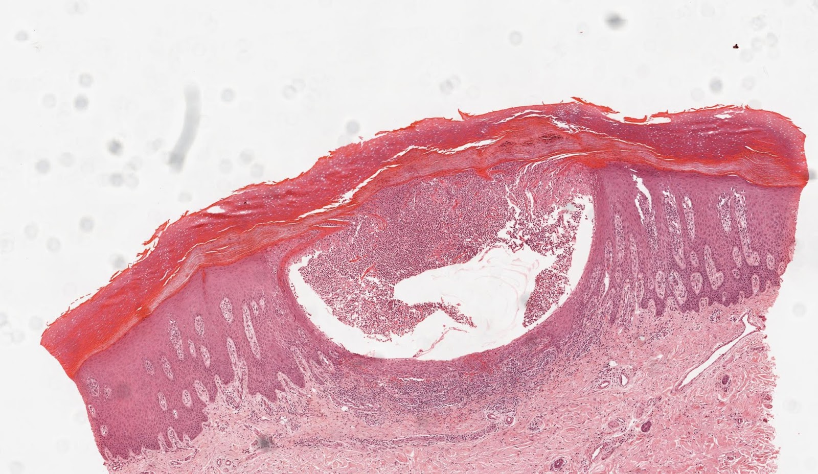 Dermpath Diagnosis: April 2014