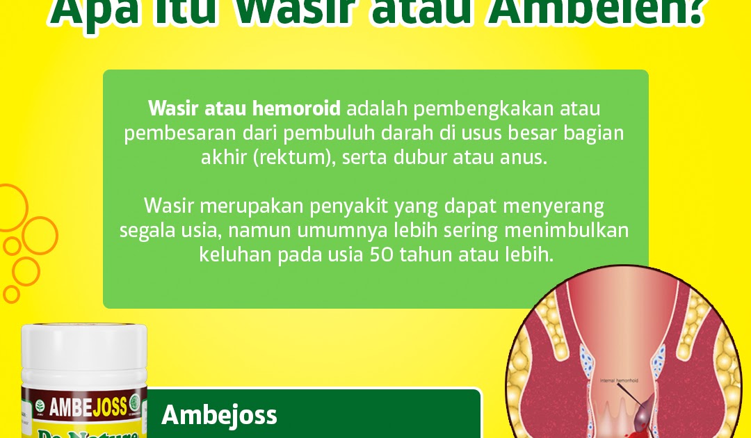 Wasir Ambeien