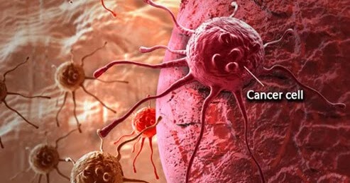 Cancer – Worldwide Facts and Figures on deadly disease