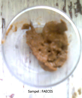 Pemeriksaan Faeces | Analis Kesehatan