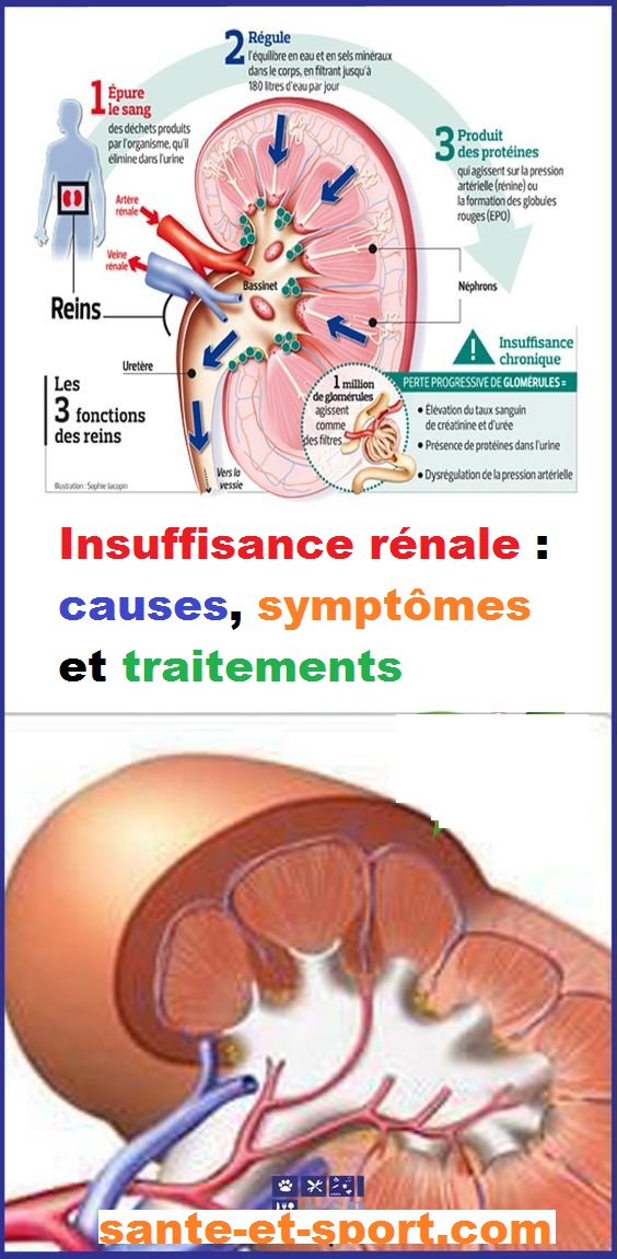 Insuffisance rénale : causes, symptômes et traitements ~ Sport et Santé