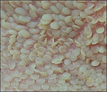 Zootecnia é 10: Anatomia e Morfologia do Rúmen.