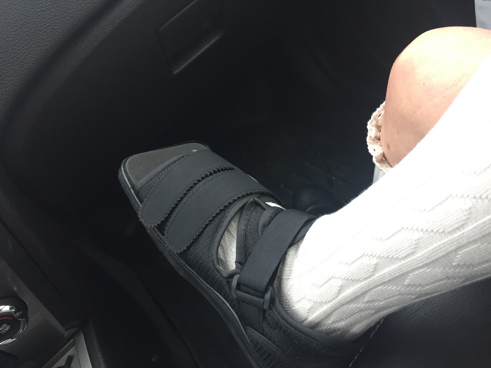 Before, During, & After Bunion Surgery...: #9 ~ Week Six Checkup and ...