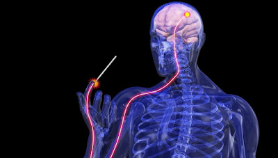KING HSAN IV: What is HSAN-IV?