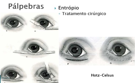 Cavalos e só !!: Entrópio