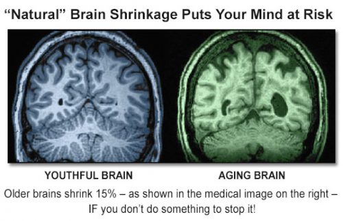 Dr Pete's Health Secrets: How to stop your brain from shrinking as we age