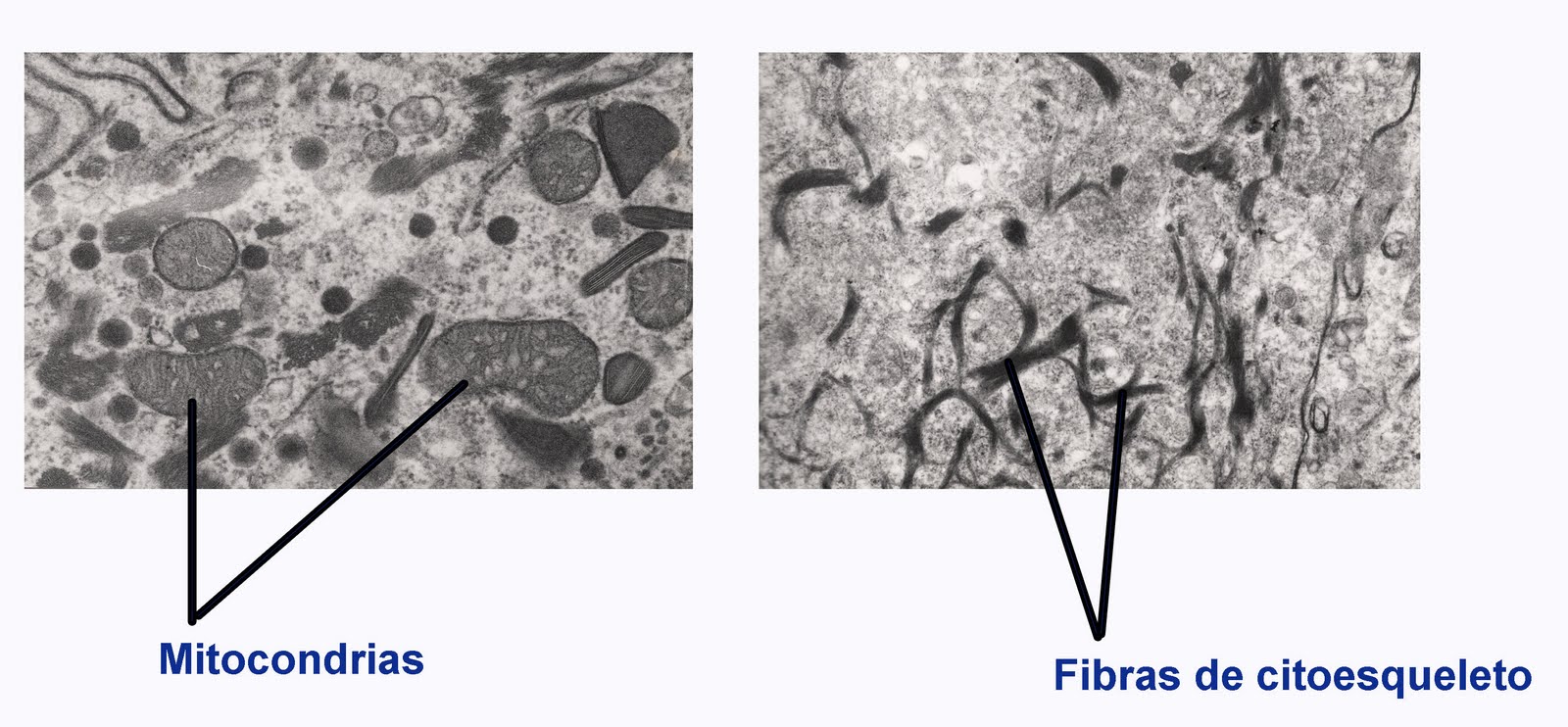 el moderno prometeo: Citoesqueleto: Filamentos Intermedios