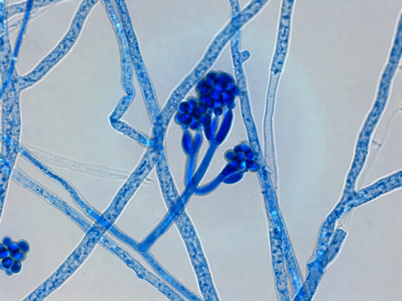 Fun With Microbiology (What's Buggin' You?): Gliocladium species