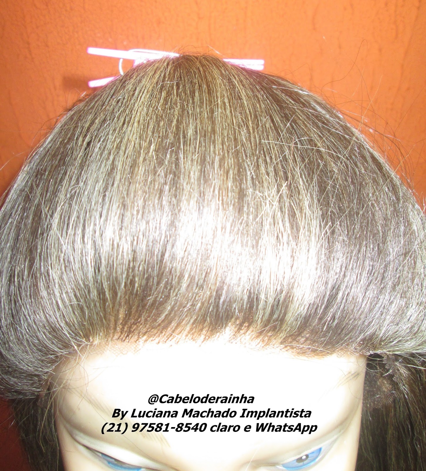 Minha frente do cabelo caiu? E agora?