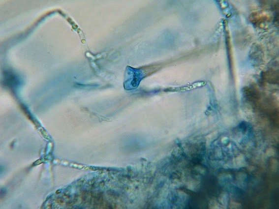 Fun With Microbiology (What's Buggin' You?): Apophysomyces elegans ...