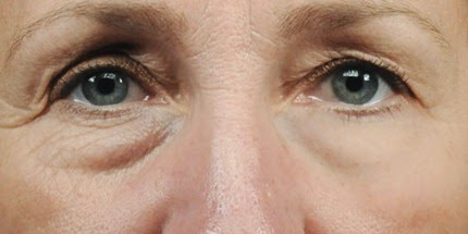 VitaskinPlus for the Beauty of your Skin: There Are 2 Main Types of ...