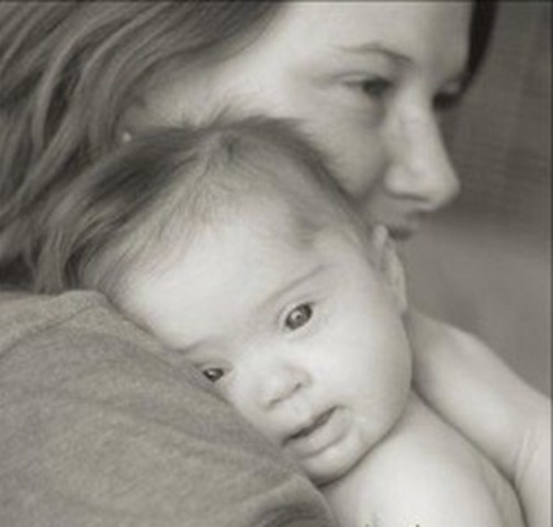 AILIX: TRATAMIENTO ODONTOLÓGICO EN PACIENTES CON SÍNDROME DE DOWN