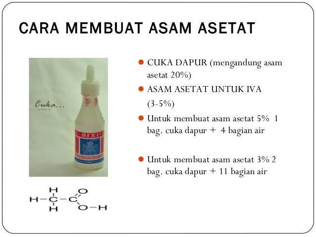 Pembuatan Asam Asetat dengan Fermentasi - Alif MH