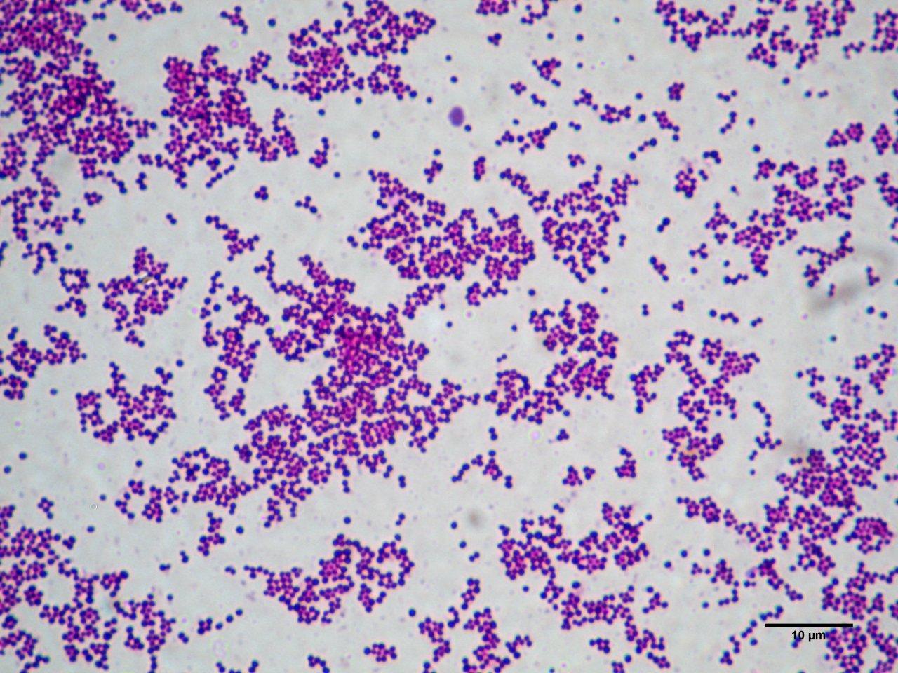 Facts about Staphylococcus