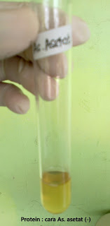 Pemeriksaan Urinalisis Lengkap | Analis Kesehatan