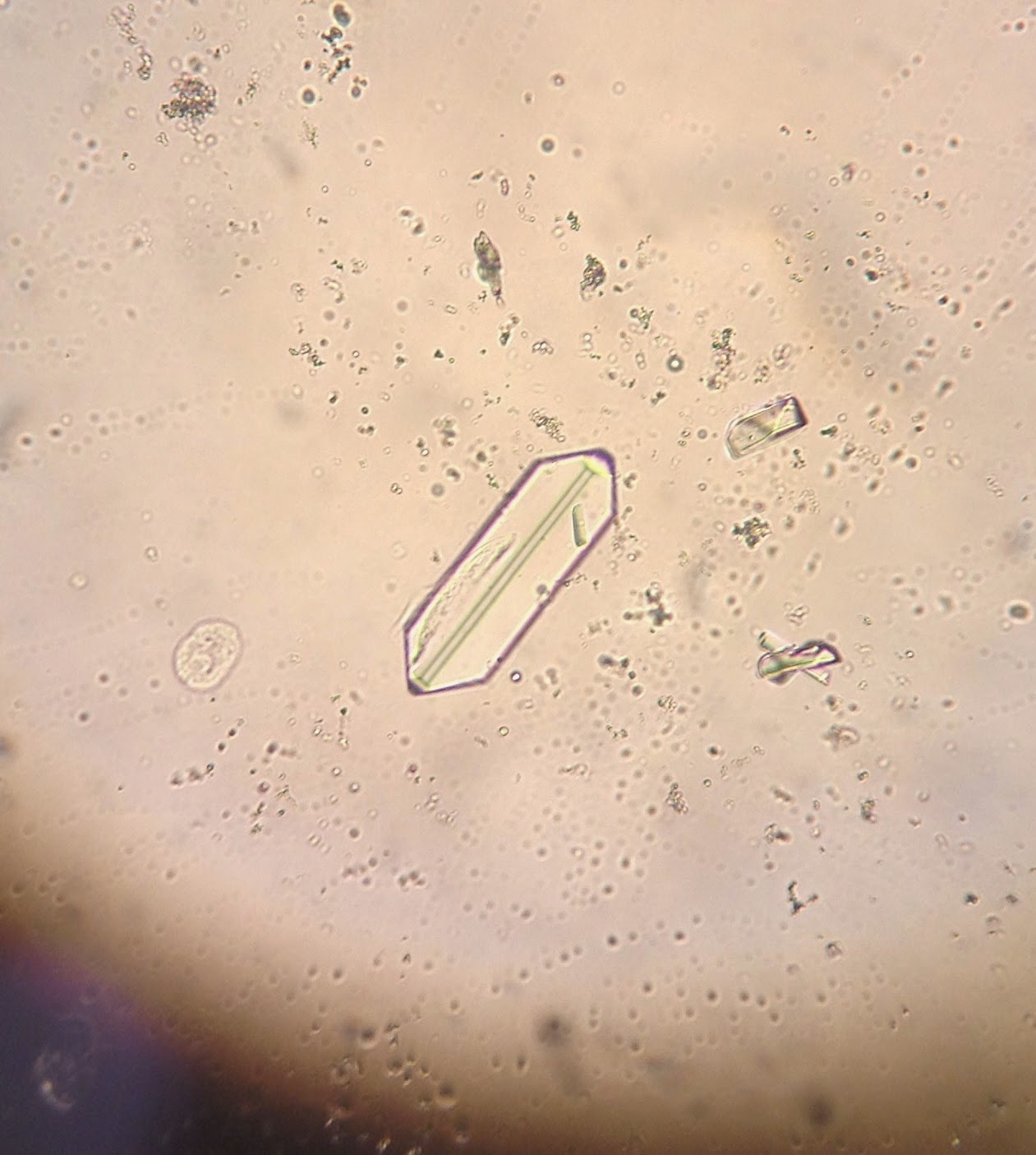 Hundhälsa +: Kristaller i urinet