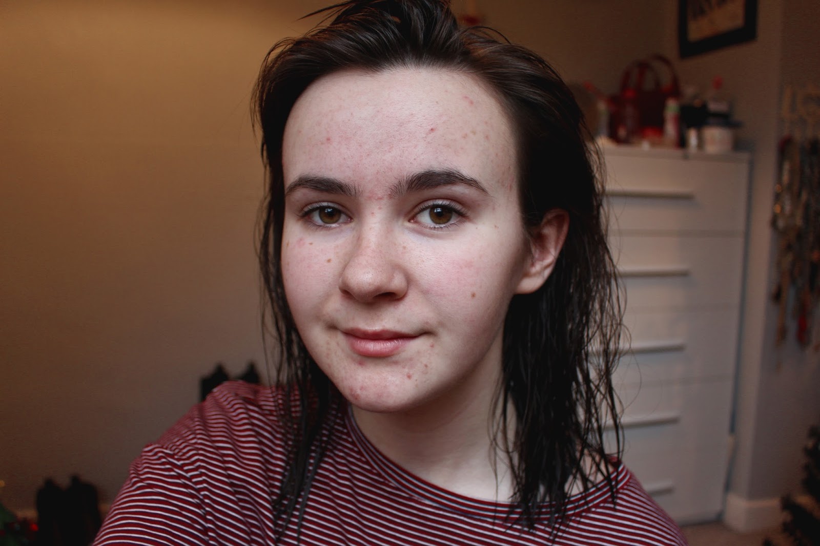 Embrace the bare face: Acne edition / Lucy Jane Fashion 🍒