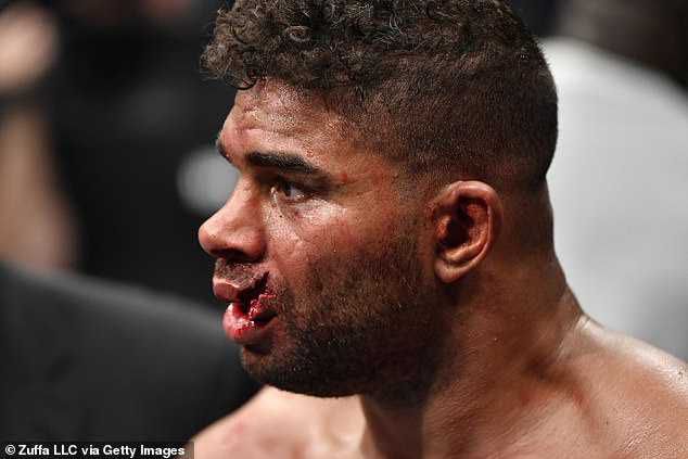 Boxing Star Alistair Overeem Lip Torn Open By Brutal Punch From ...