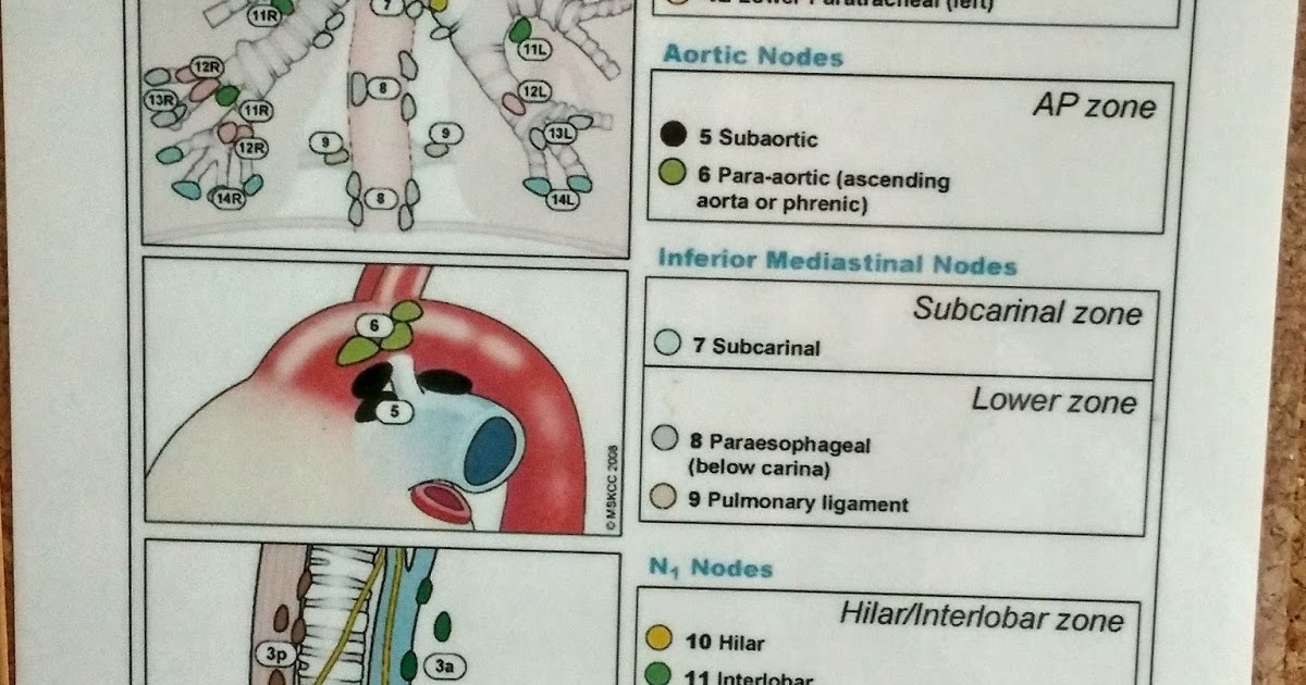 Menentukan Staging/ Stadium Kanker Paru