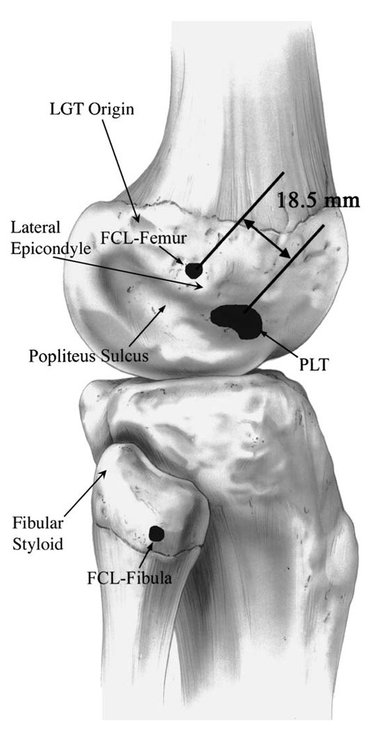 Popliteus Muscle Popliteus Complex Medical Anatomical Knowledge Center Popliteus Muscle Popliteus Complex Medical Anatomical Knowledge Center