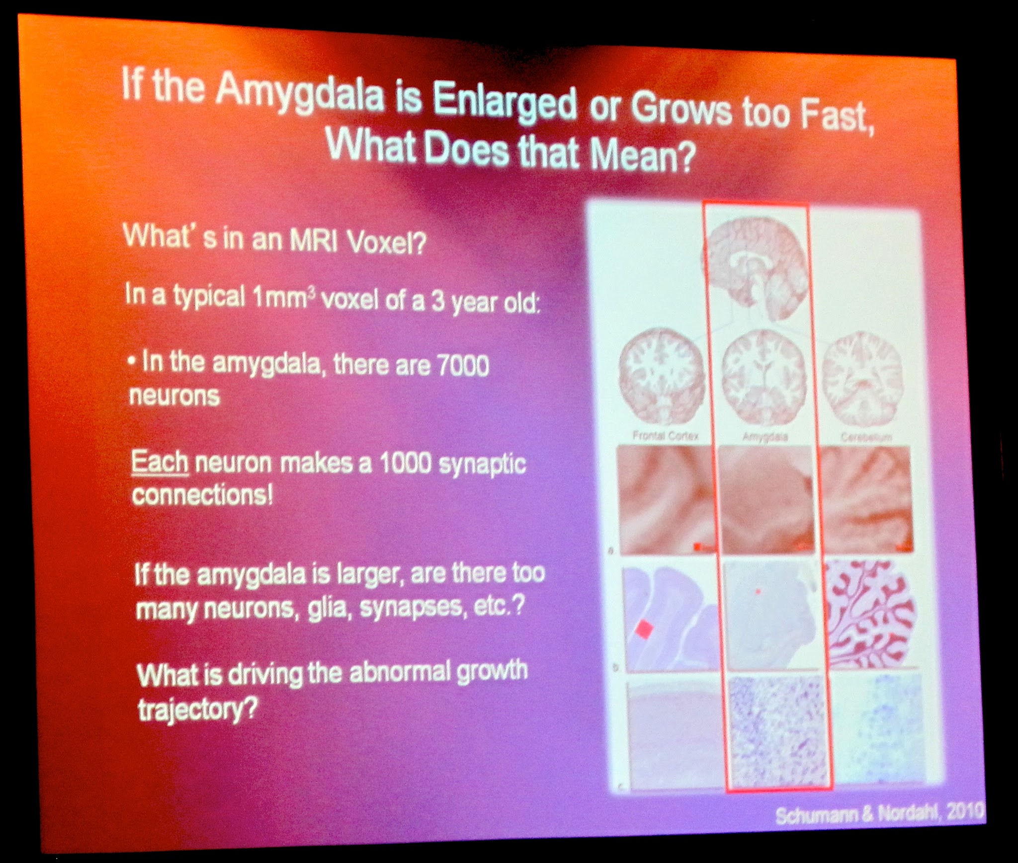 IMFAR 2011: Neuropathology of the Amygdala in Autism — THINKING PERSON ...