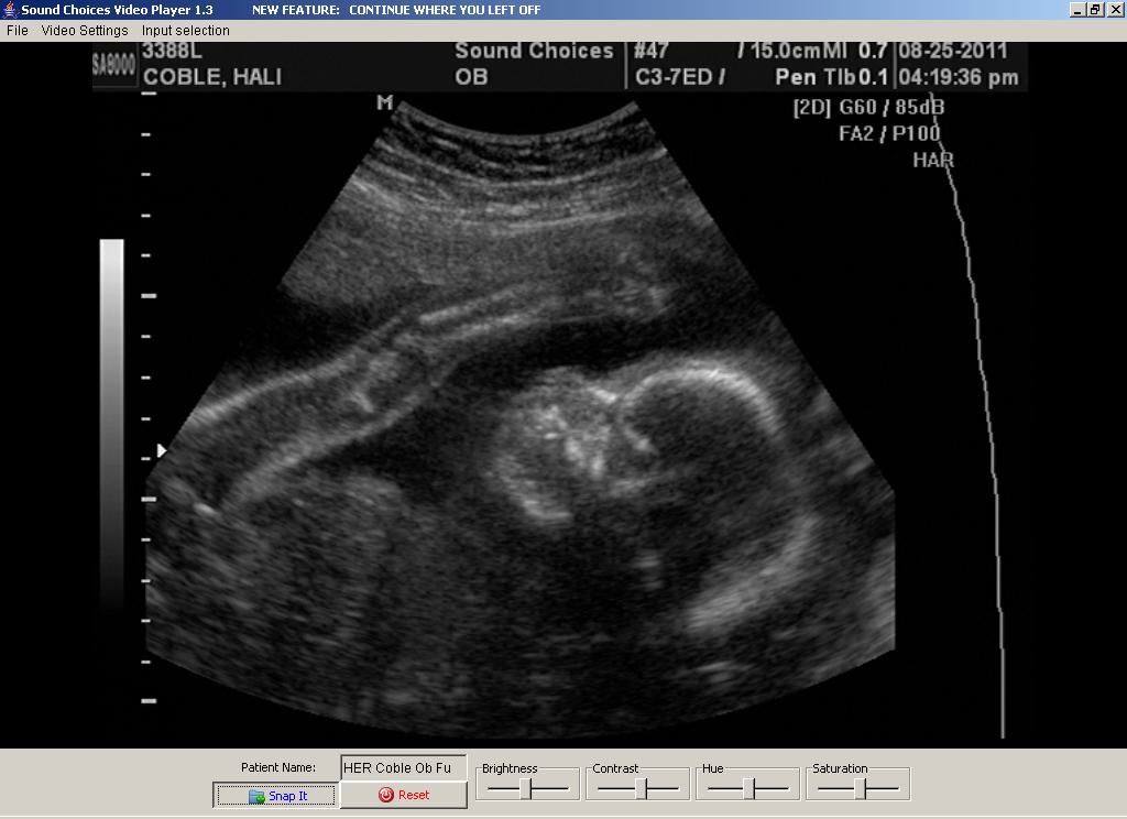 We Are the Cobles: 25 weeks down!