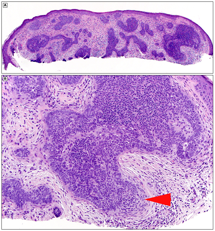 EL RINCÓN DE LA MEDICINA INTERNA. juanpedromacaluso@yahoo.com.ar ...