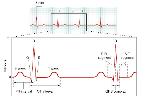 HOW TO READ AN ECG