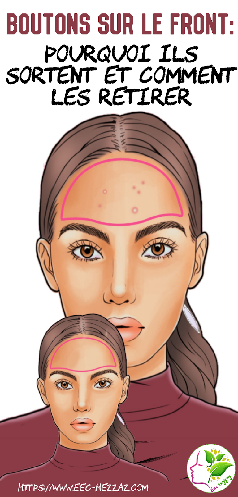 Boutons sur le front: pourquoi ils sortent et comment les retirer
