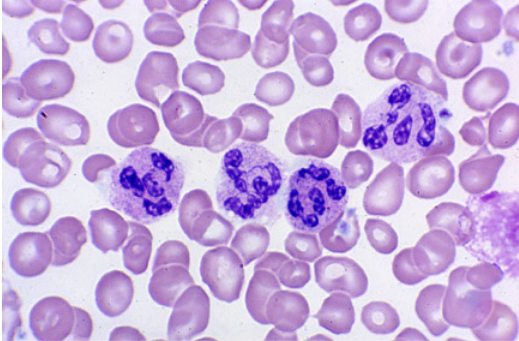 VETERINARY HEMATOLOGY DEXTERVET: Hypersegmented Neutrophils
