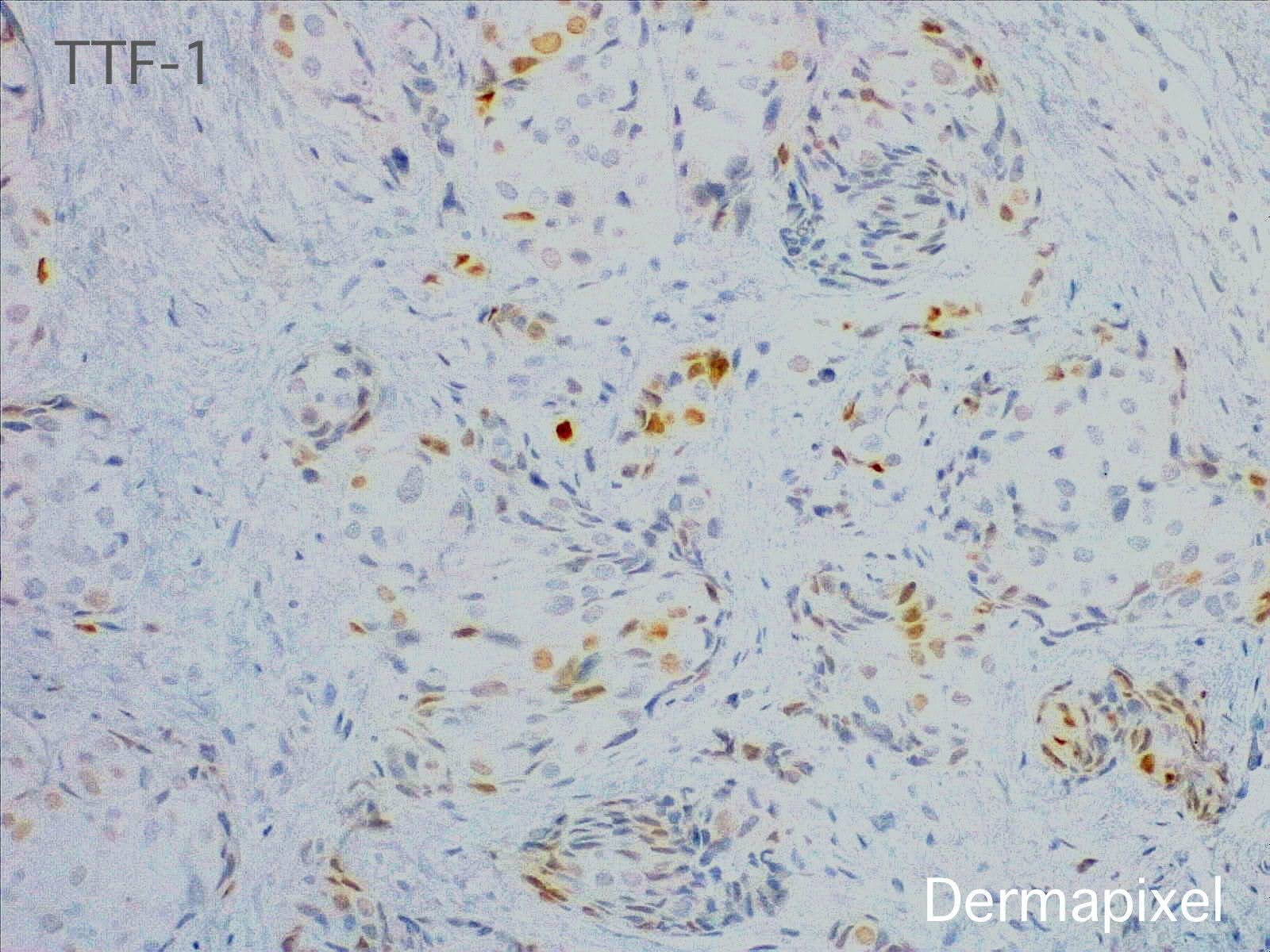 Dermapixel: febrero 2021