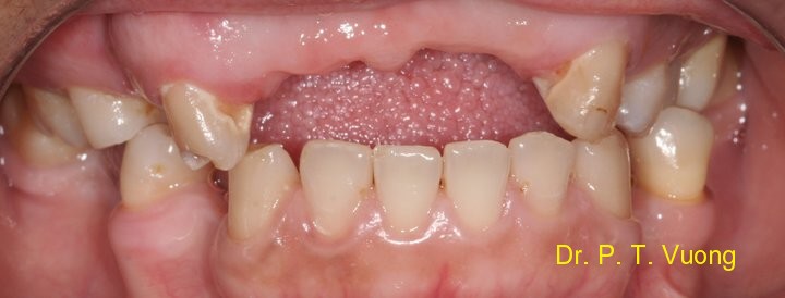 Dr. Phuoc Vuong Dentist - Phuoc T. Vuong, DMD, MS - Dr. Phil T. Vuong ...