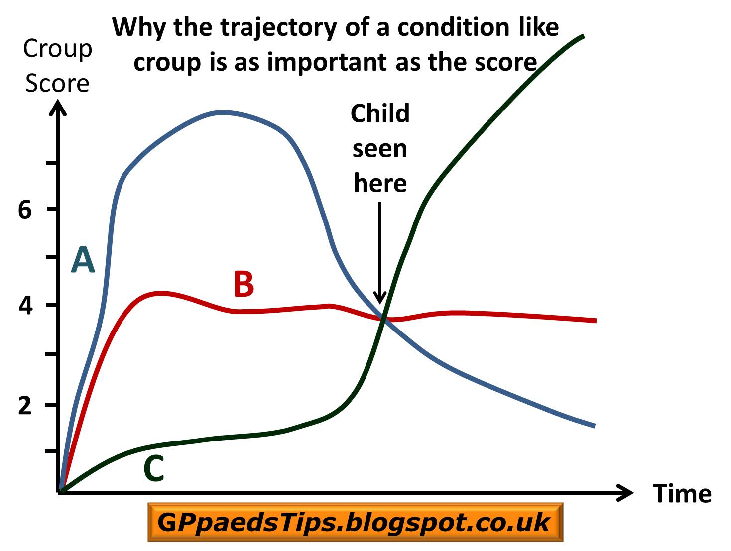 Paediatrics for Primary Care (and anyone else): Croup - proof that a ...