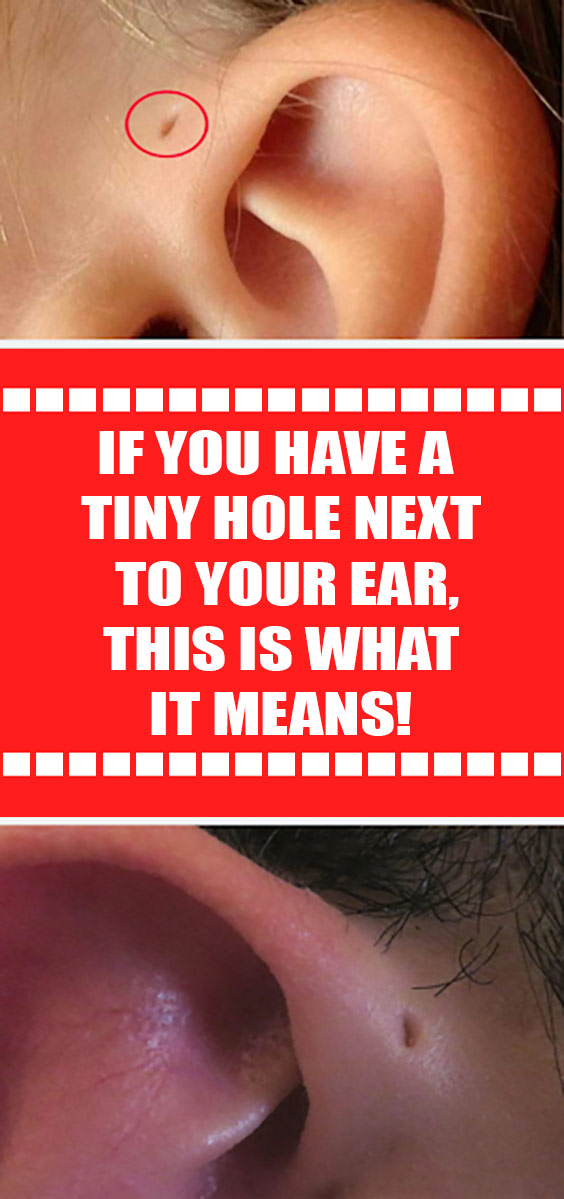 Did You Ever Wonder What This Tiny Hole Next To Your Ear Is There For did-you-ever-wonder-what-this-tiny-hole-next-to-your-ear-is-there-for