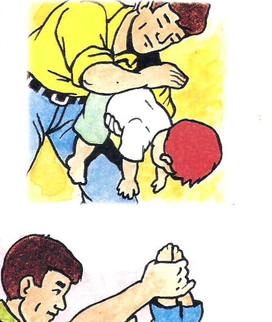 Primeros Auxilios: Asfixia