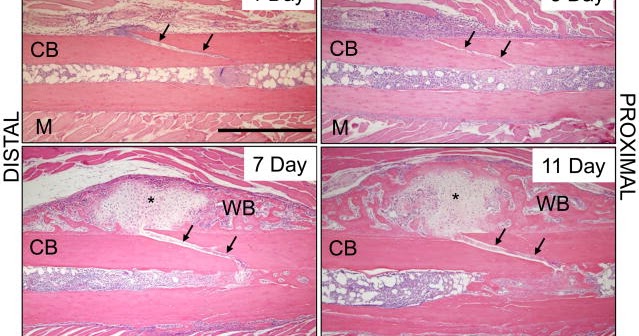 The Quest for Height: Grow Taller | Increase Height | Bone Size: Gene ...