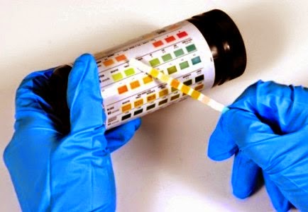 Analis Kesehatan: Pemeriksaan Urin Rutin