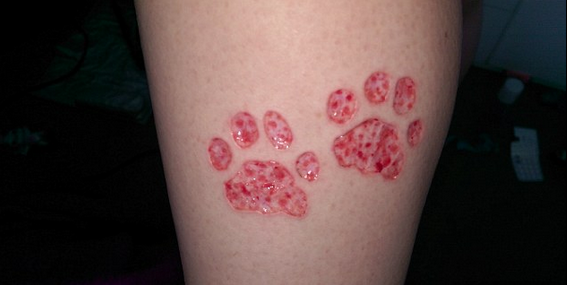 Eliora Gist Blog: Woman has her skin cut with a scalpel and PEELED off ...