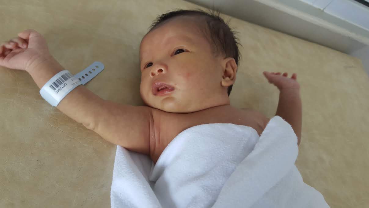 Pengalaman Bayi Kuning dan Penyebab Kuning pada Bayi (Jaundice in ...